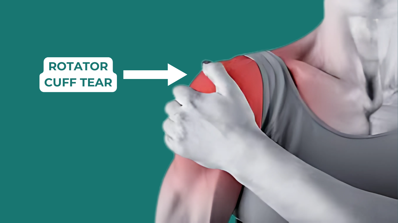 Get Relief from Rotator Cuff Pain: Here's How